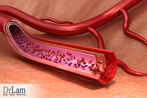 A CBS Mutation May Be Responsible For Your Health Issues