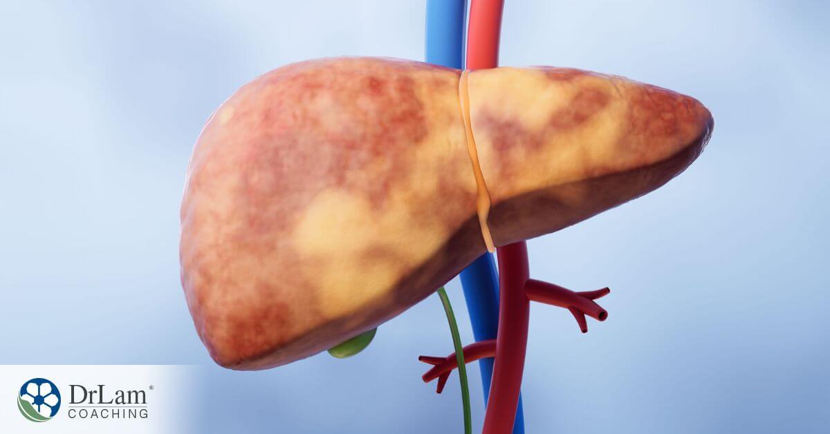 Can Fatty Liver Be Reversed? Ways to Reduce Liver Fat | Dr. Lam